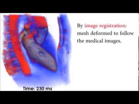 Blood Flow Simulations – FYFD