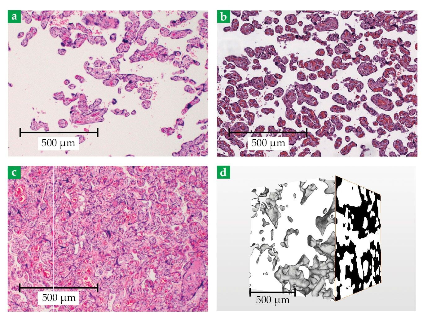 Disease and Placental Flows – FYFD